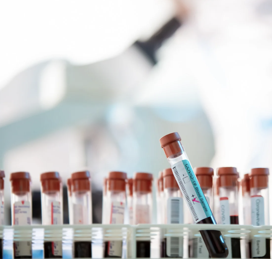 On-Site Lab Services - AMC Urgent Care Plus